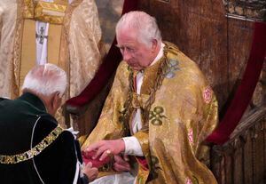 ¿Por qué el rey Carlos III tiene los dedos como salchichas?